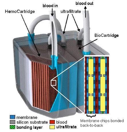 Scientists Develop First Ever Artificial Implantable Kidney - The Tech ...