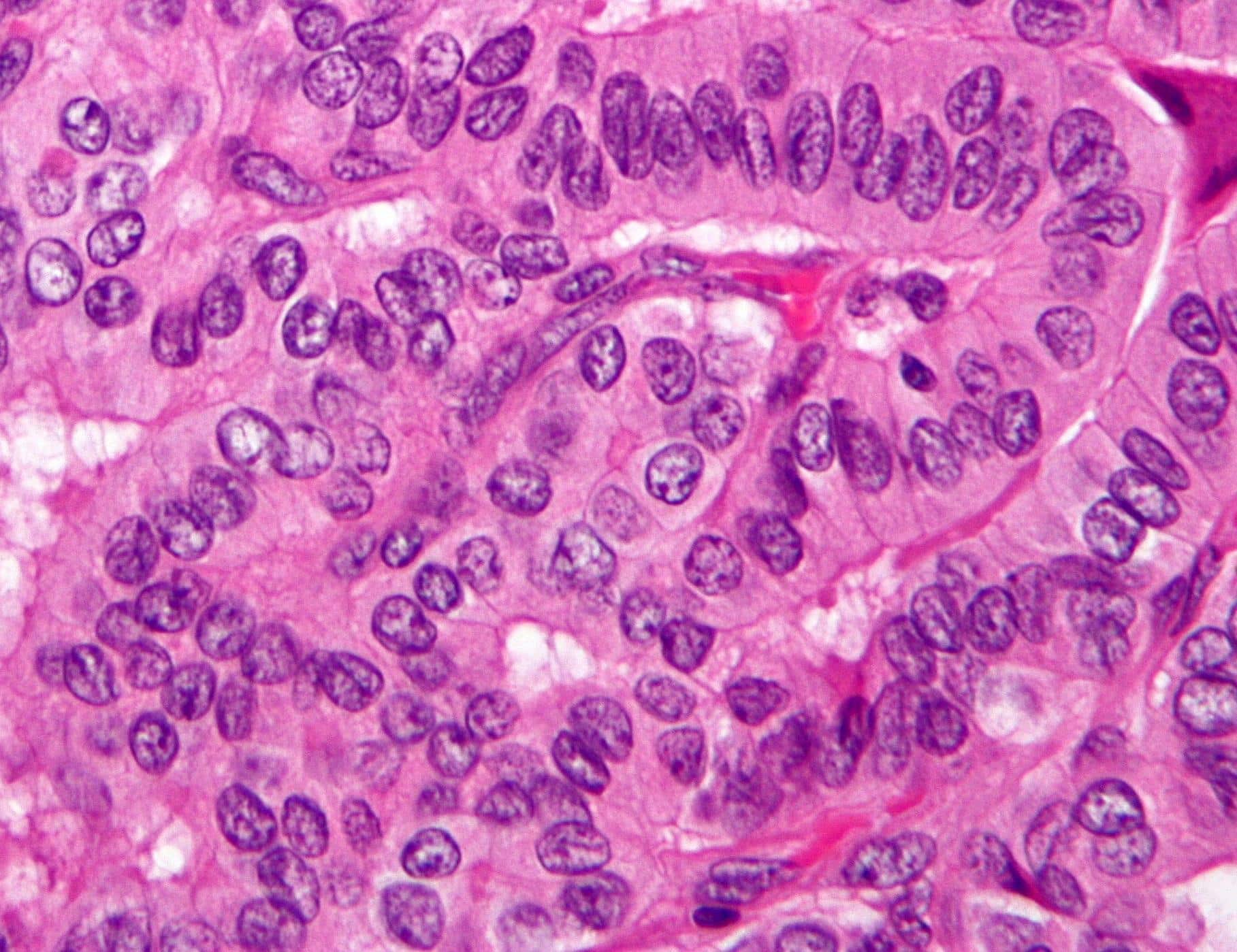 Trip To Outer Space Slows Down The Growth Of Cancer Cells - The Tech ...